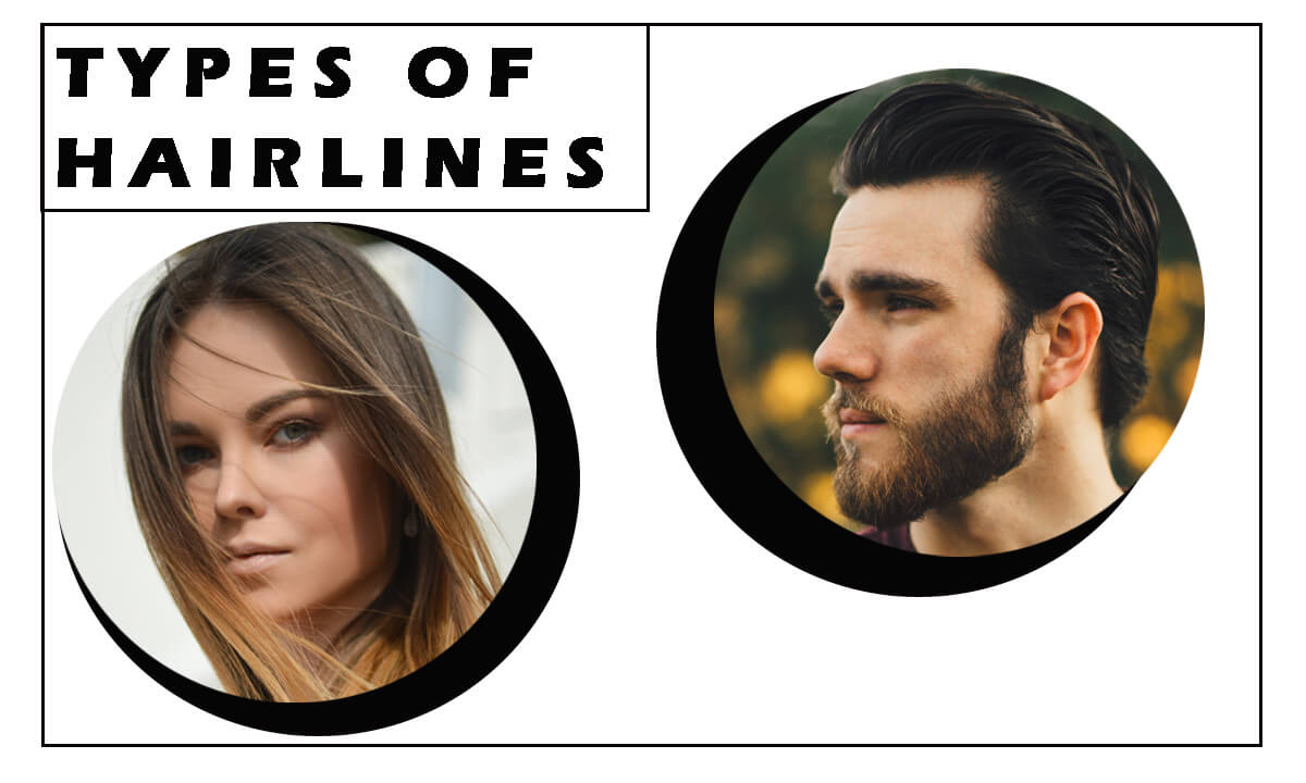 9 Different Hairline Types in Men and Women - 365 gorgeous