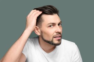 9 Different Hairline Types in Men and Women - 365 gorgeous