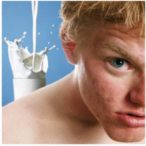Boiled Milk For Face: Should You Try?