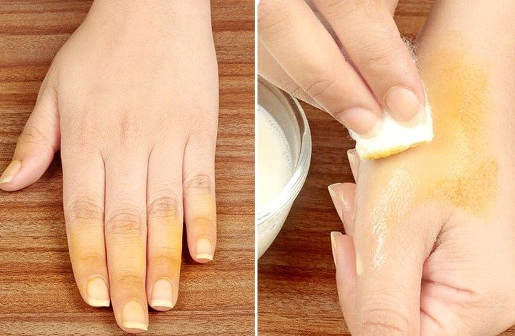 How To Remove Turmeric Stains From Skin